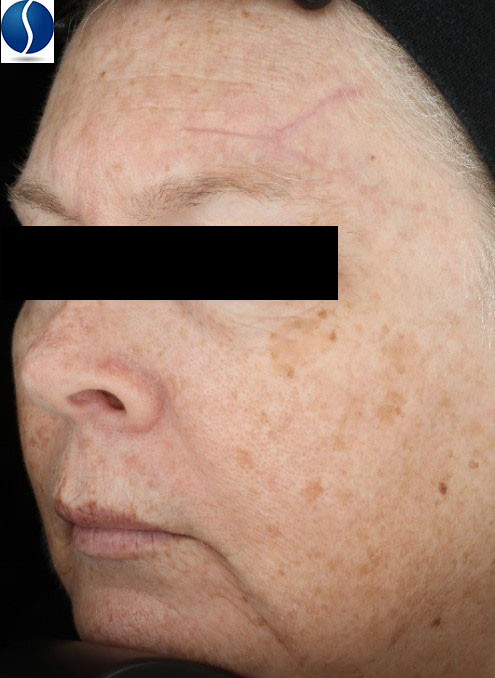 Skin Conditions - SGS Clinical Studies