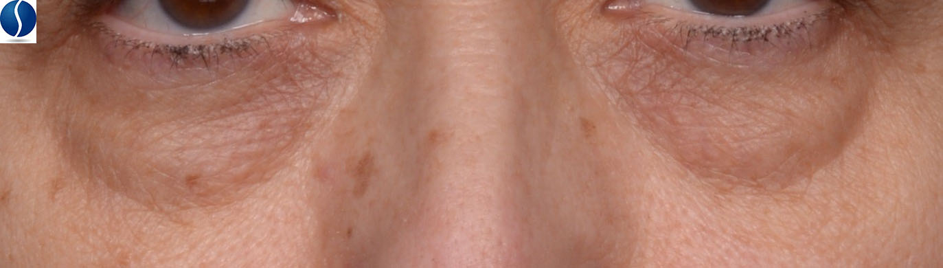 Skin Conditions - SGS Clinical Studies