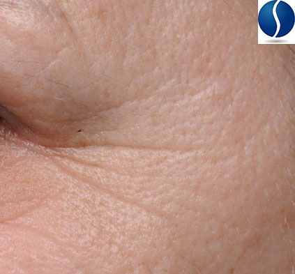 Skin Conditions - SGS Clinical Studies