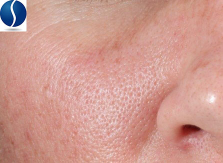 Skin Conditions - SGS Clinical Studies