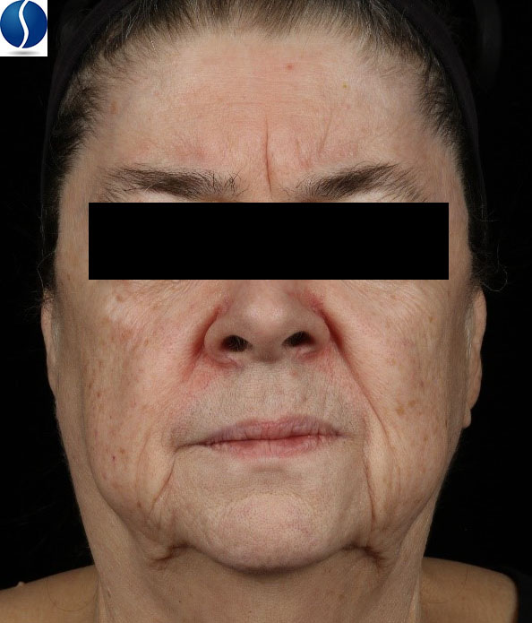 Skin Conditions - SGS Clinical Studies