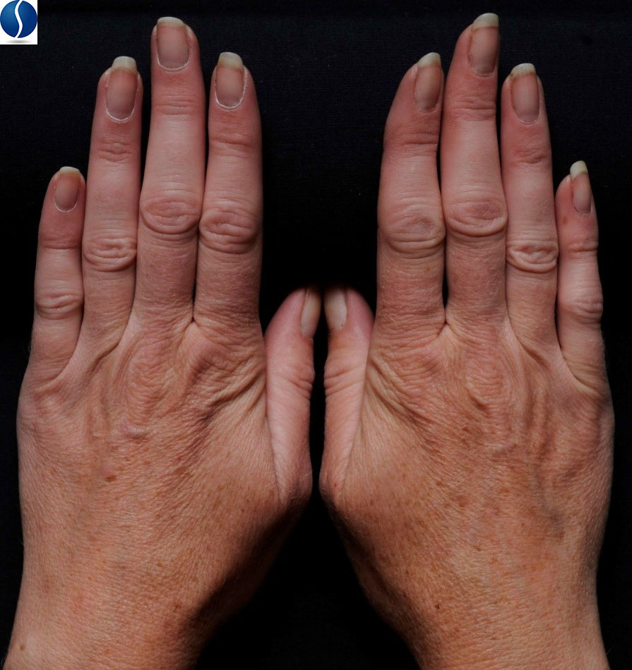 Skin Conditions - SGS Clinical Studies