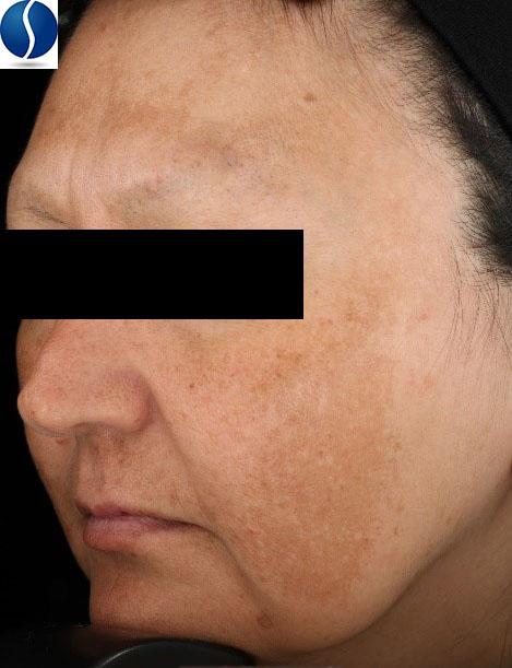 Skin Conditions - SGS Clinical Studies